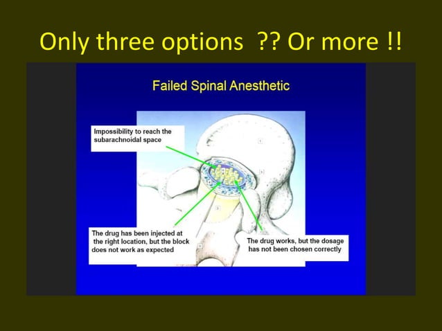 Failed spinal-anesthesia-mgmc | PPTX