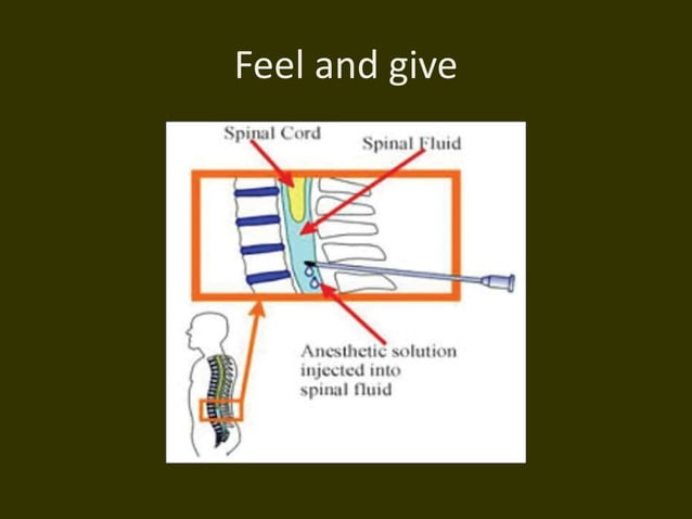Failed spinal-anesthesia-mgmc | PPTX