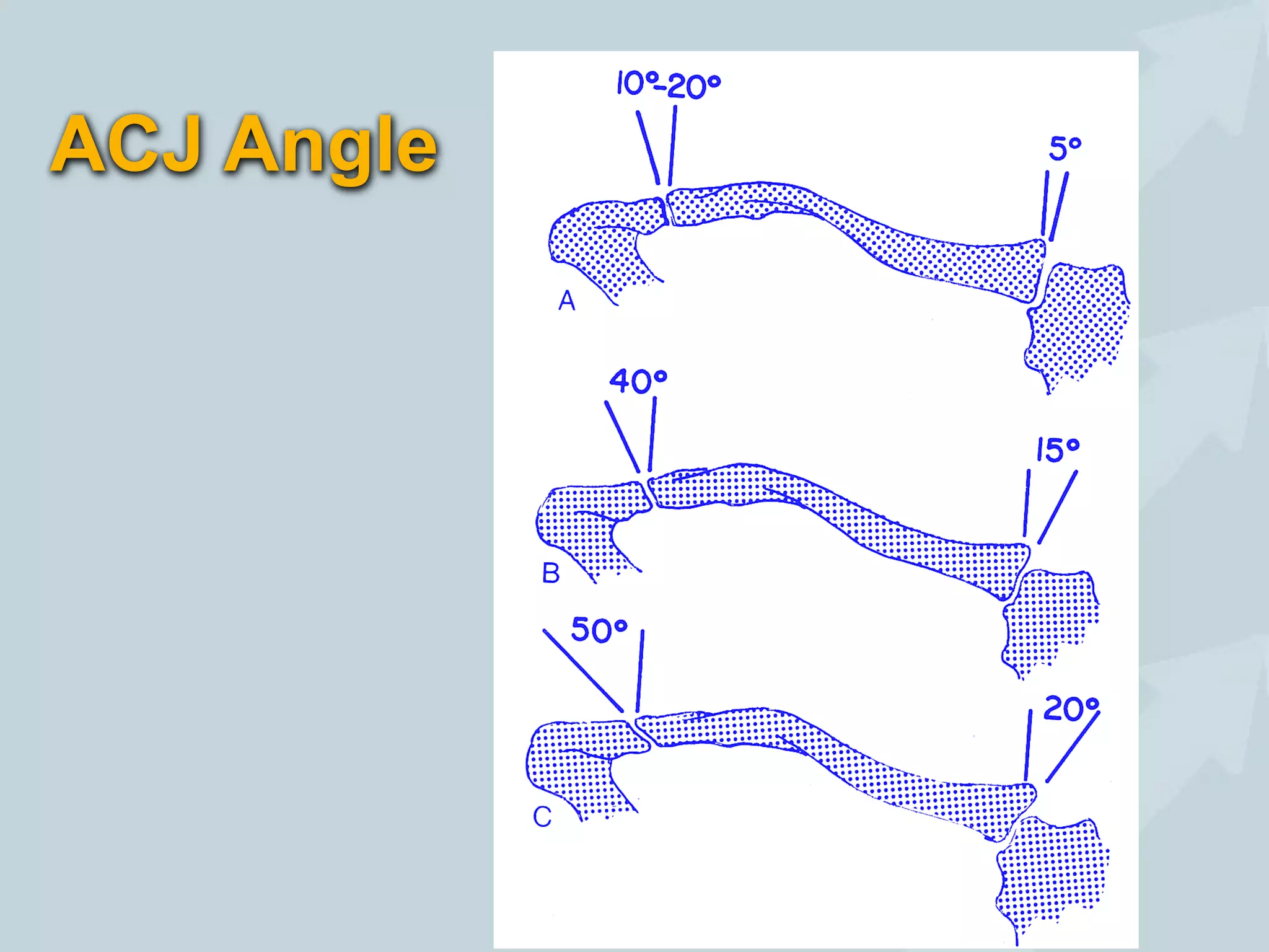 Failed acj excision | KEY