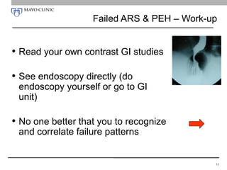 Failed Fundoplication Surgery | PPT