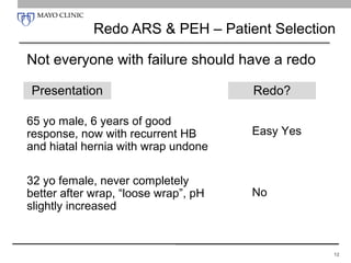 Failed Fundoplication Surgery | PPT