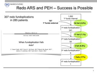 Failed Fundoplication Surgery | PPT