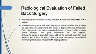 Failed Back Surgery Syndrome (FBSS).pptx | Physical Therapy | Wellness