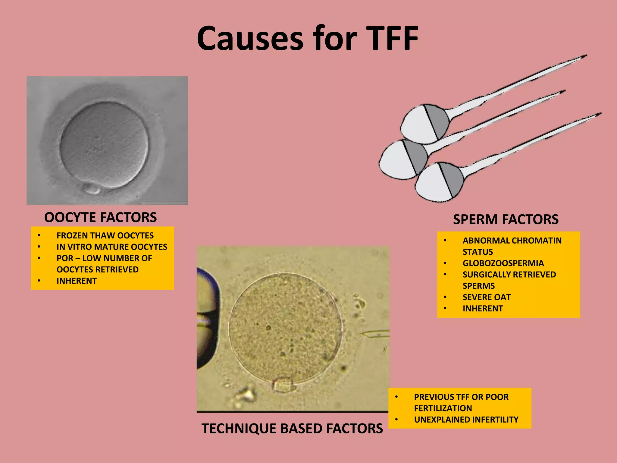 FAILED OR ABNORMAL FERTILIZATION.pptx