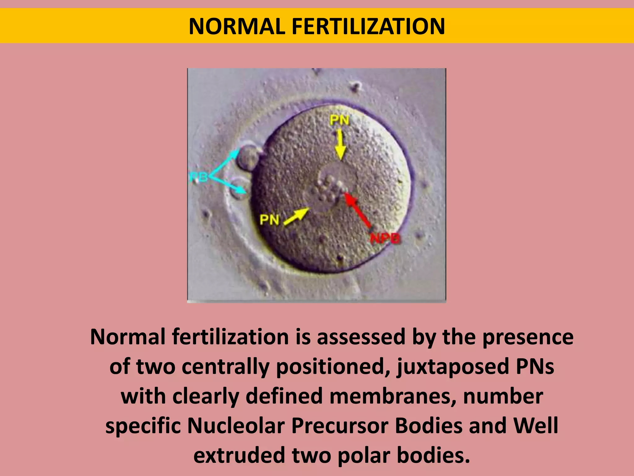 FAILED OR ABNORMAL FERTILIZATION.pptx