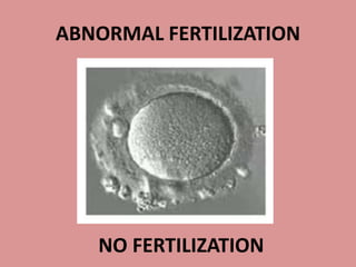 FAILED OR ABNORMAL FERTILIZATION.pptx
