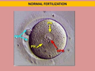 FAILED OR ABNORMAL FERTILIZATION.pptx