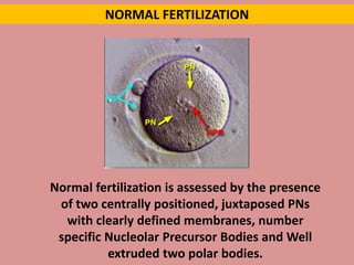 FAILED OR ABNORMAL FERTILIZATION.pptx