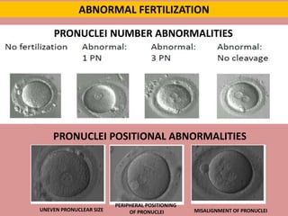 FAILED OR ABNORMAL FERTILIZATION.pptx