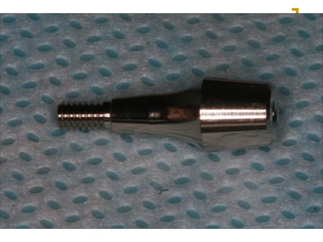 Failed root resection case | PPT