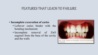 Failure of composites | PPTX