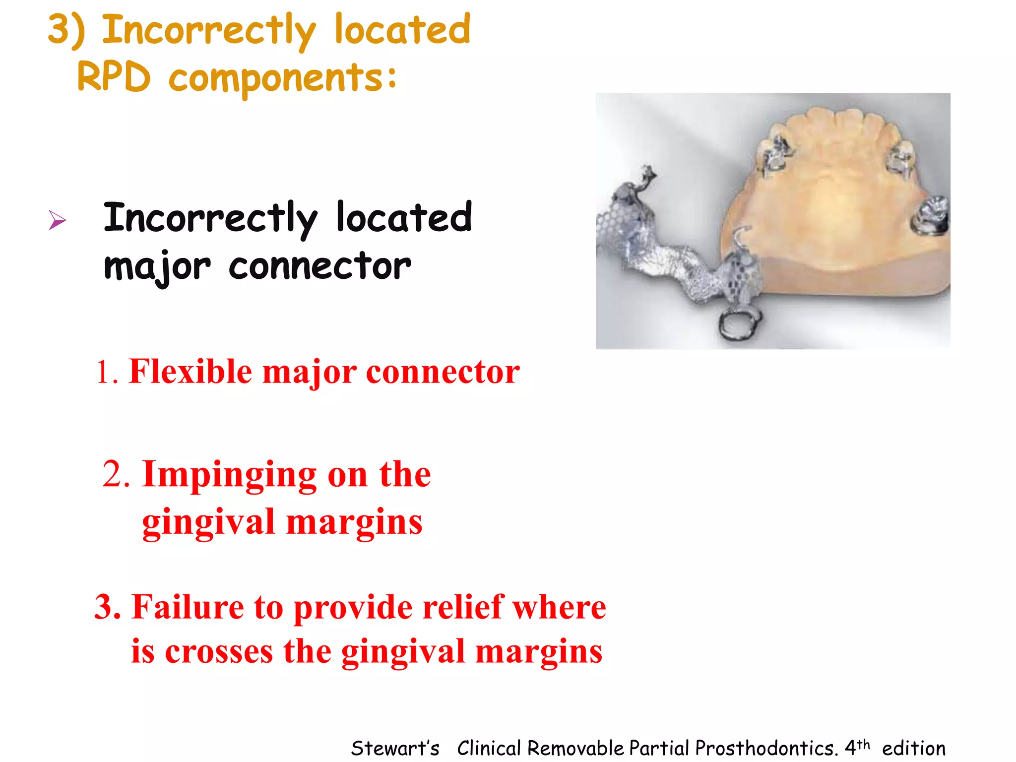 Failure in removable part denture my ppt | PPTX