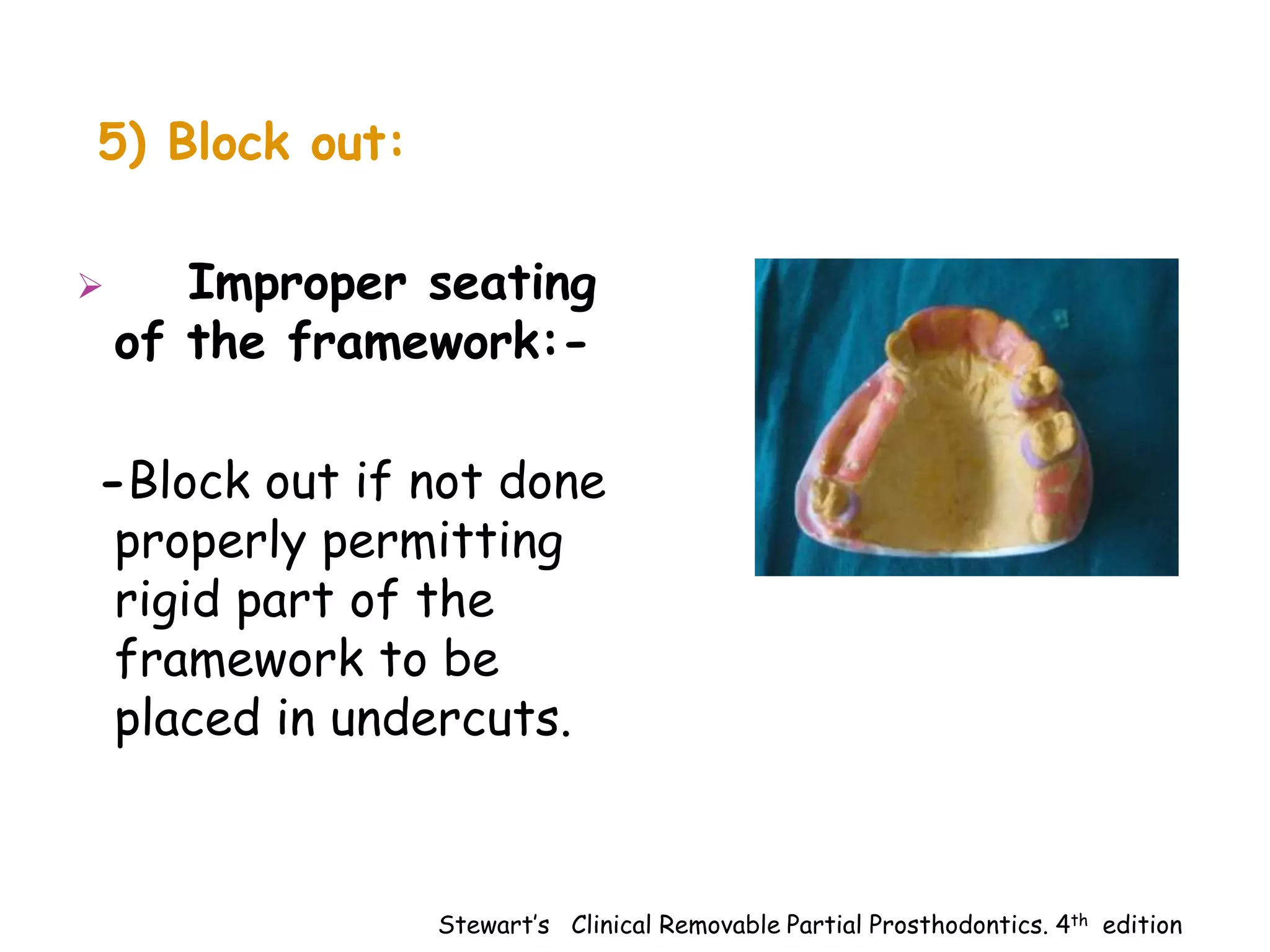Failure in removable part denture my ppt | PPTX
