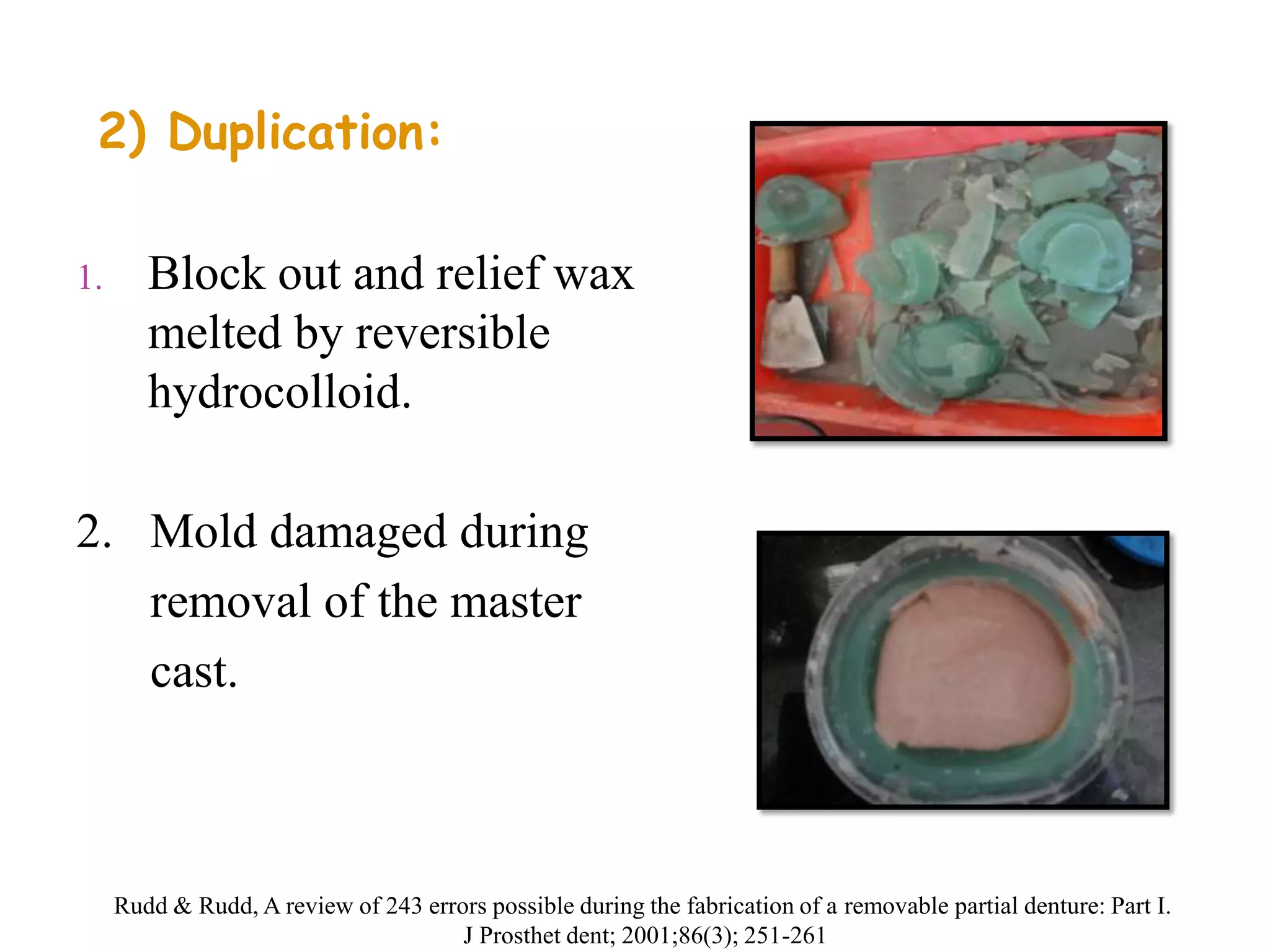 Failure in removable part denture my ppt | PPTX