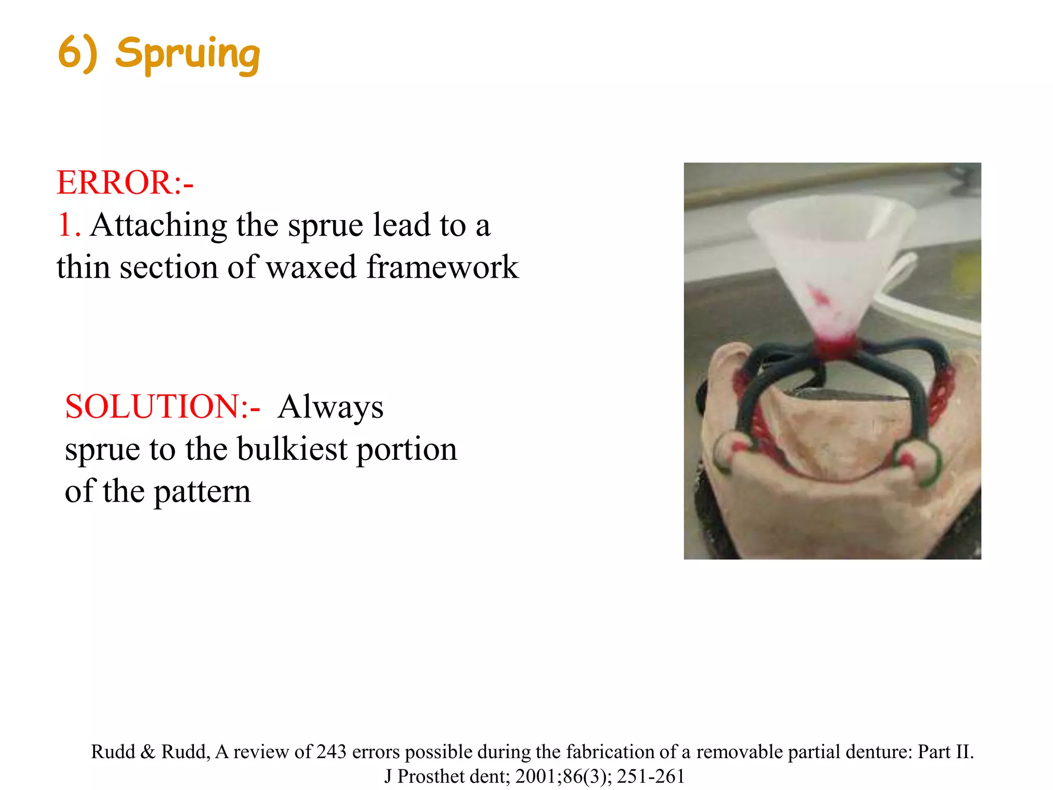 Failure in removable part denture my ppt | PPTX