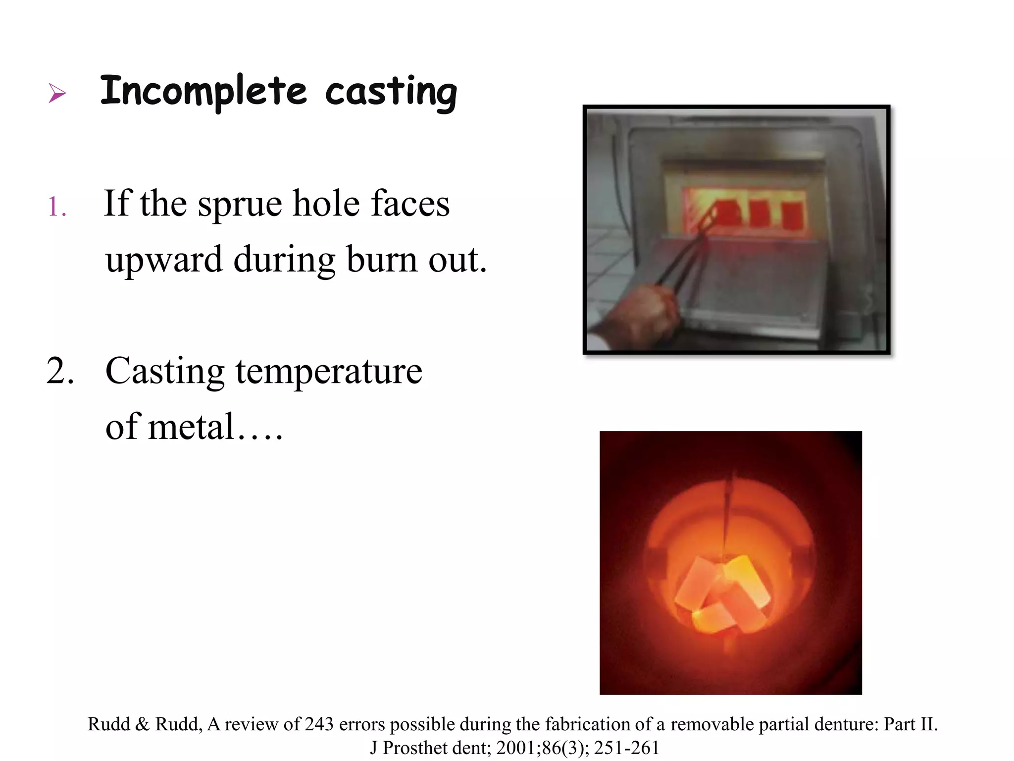 Failure in removable part denture my ppt | PPTX