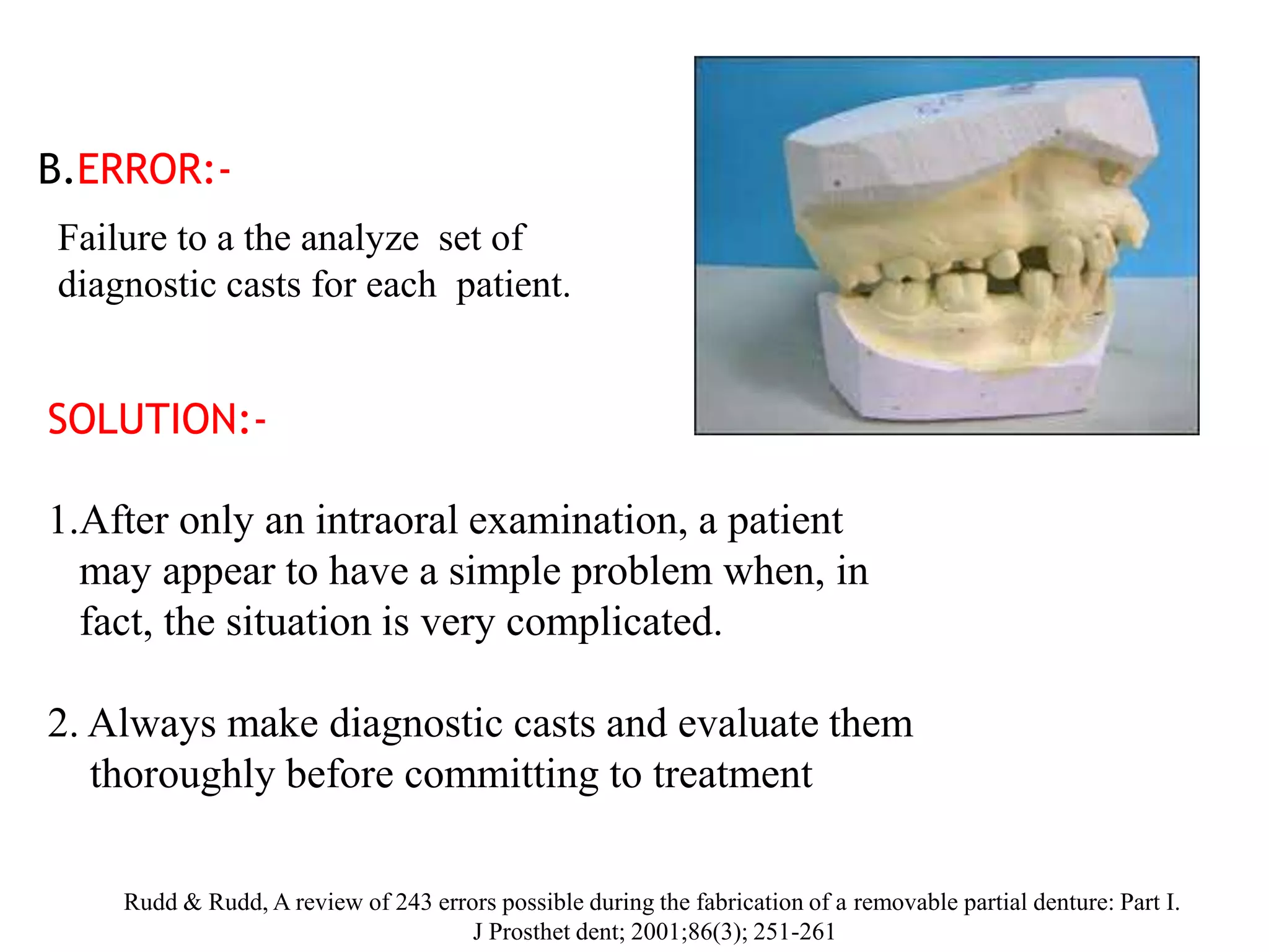 Failure in removable part denture my ppt | PPTX