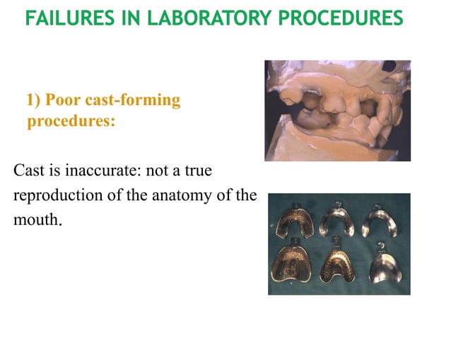 Failure in removable part denture my ppt | PPTX