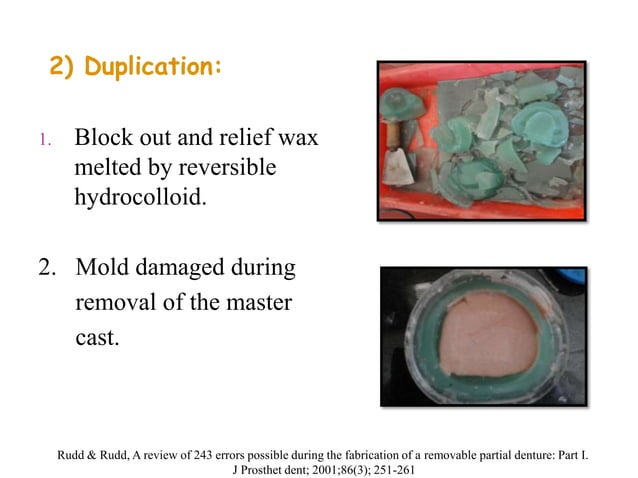 Failure in removable part denture my ppt | PPTX