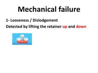 failure in fixed prosthodontics biological or mechanical | PDF