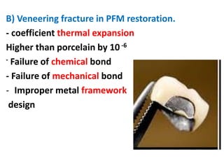 failure in fixed prosthodontics biological or mechanical | PDF