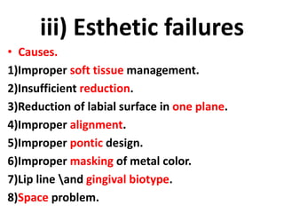 failure in fixed prosthodontics biological or mechanical | PDF