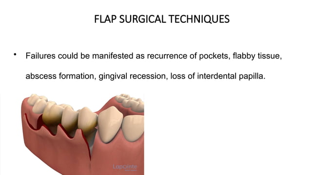 failure in Periodontal Therapy - Dr Smijal Gopalan Marath - Specialist ...