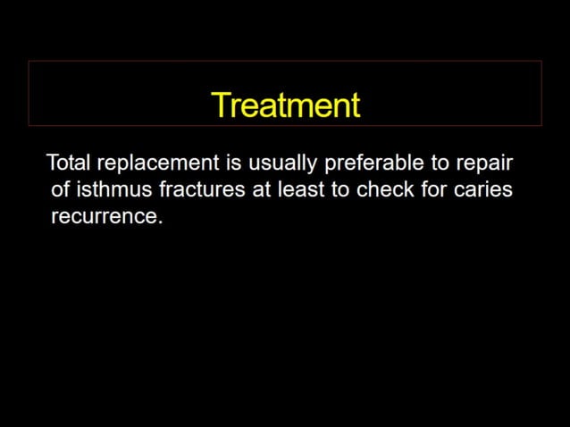 failure of composite restoration by Dr Islam Alsakkaf.pptx