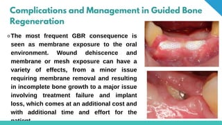 Failure of dental implant...........pptx