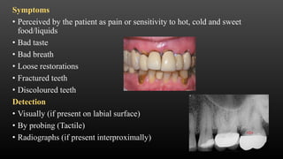 FAILURES IN FIXED PARTIAL DENTURES | PPTX