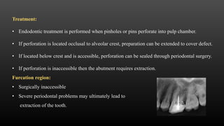 FAILURES IN FIXED PARTIAL DENTURES | PPTX