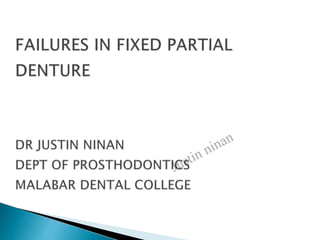 Failures in FPD Dr Justin Ninan, Malabar Dental College | PPT