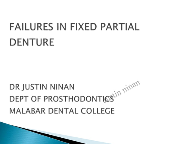 Failures in FPD Dr Justin Ninan, Malabar Dental College | PPT