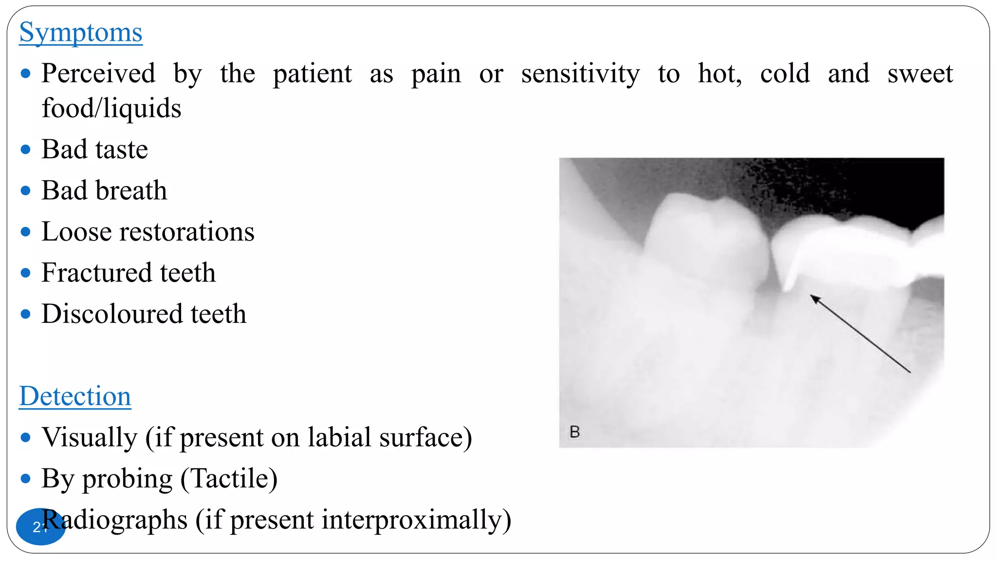 Failures in Fixed Partial Denture | PPTX
