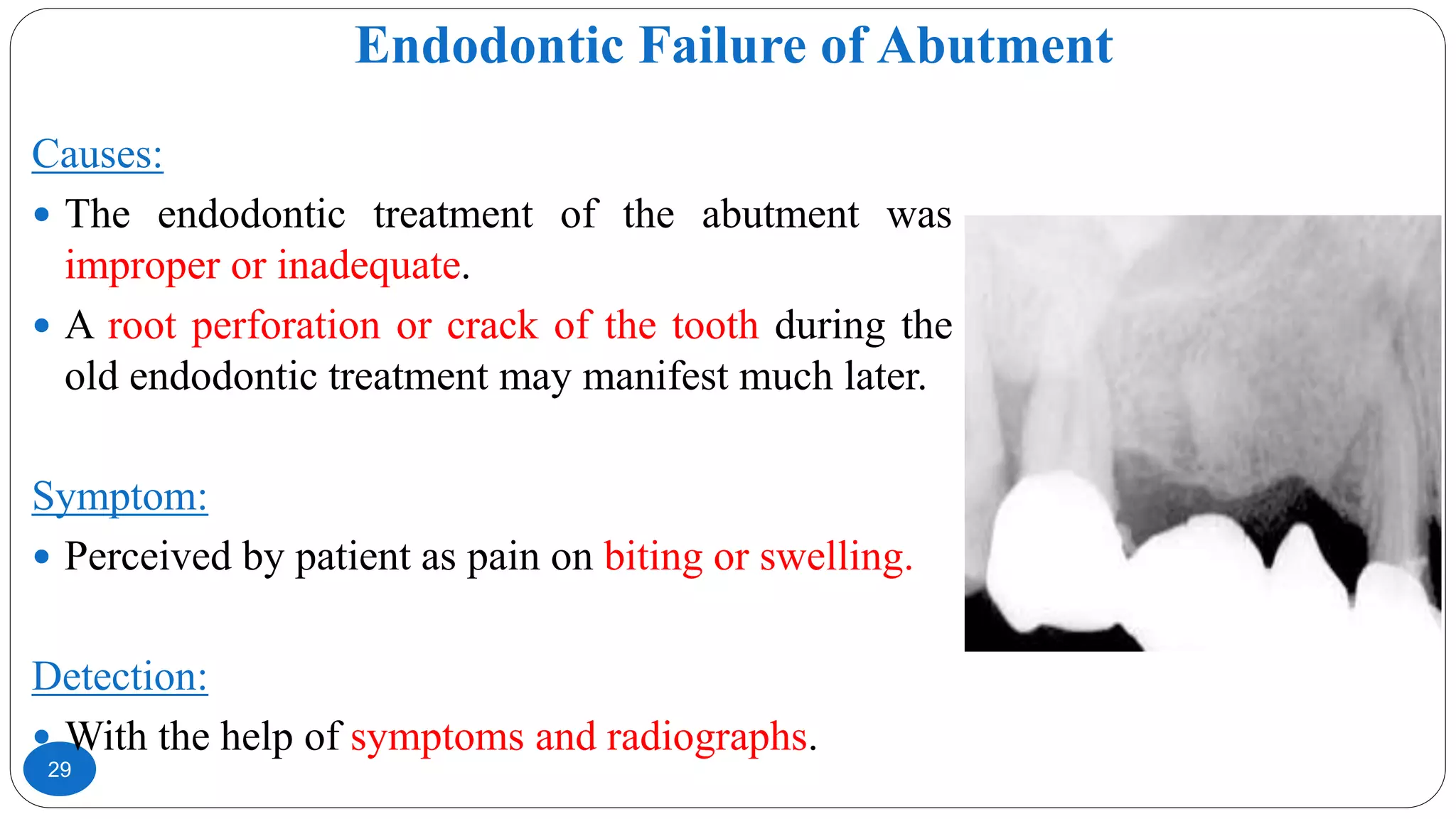 Failures in Fixed Partial Denture | PPTX