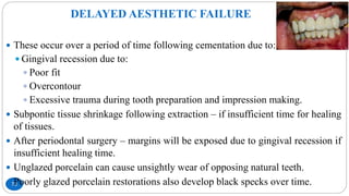 Failures in Fixed Partial Denture | PPTX