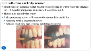 Failures in Fixed Partial Denture | PPTX