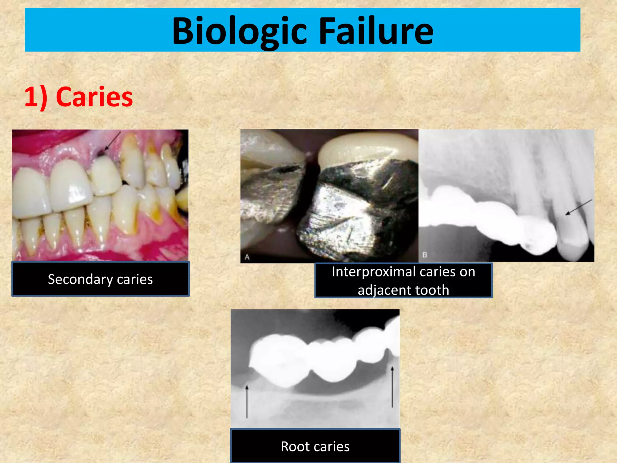 Failures in FPD.pptx