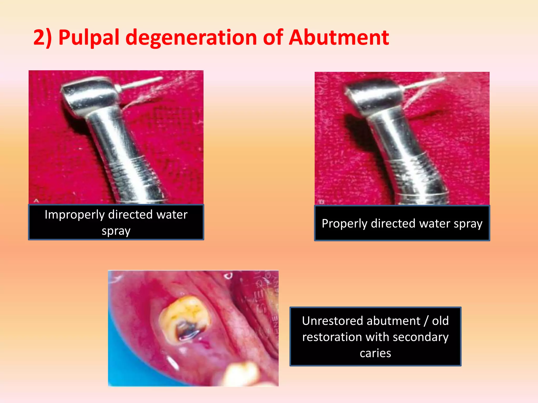 Failures in FPD.pptx