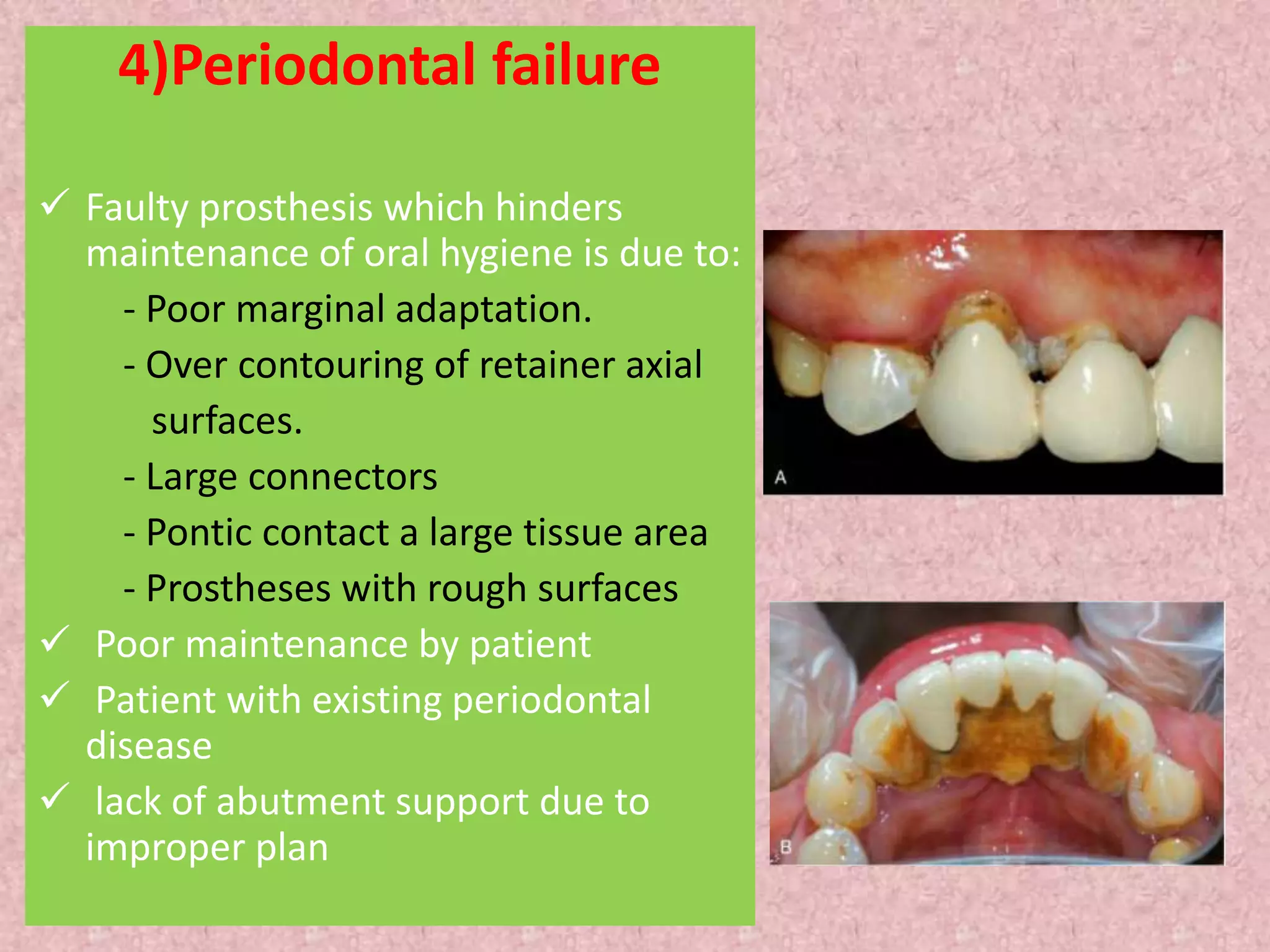 Failures in FPD.pptx