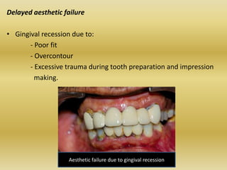 Failures in FPD.pptx