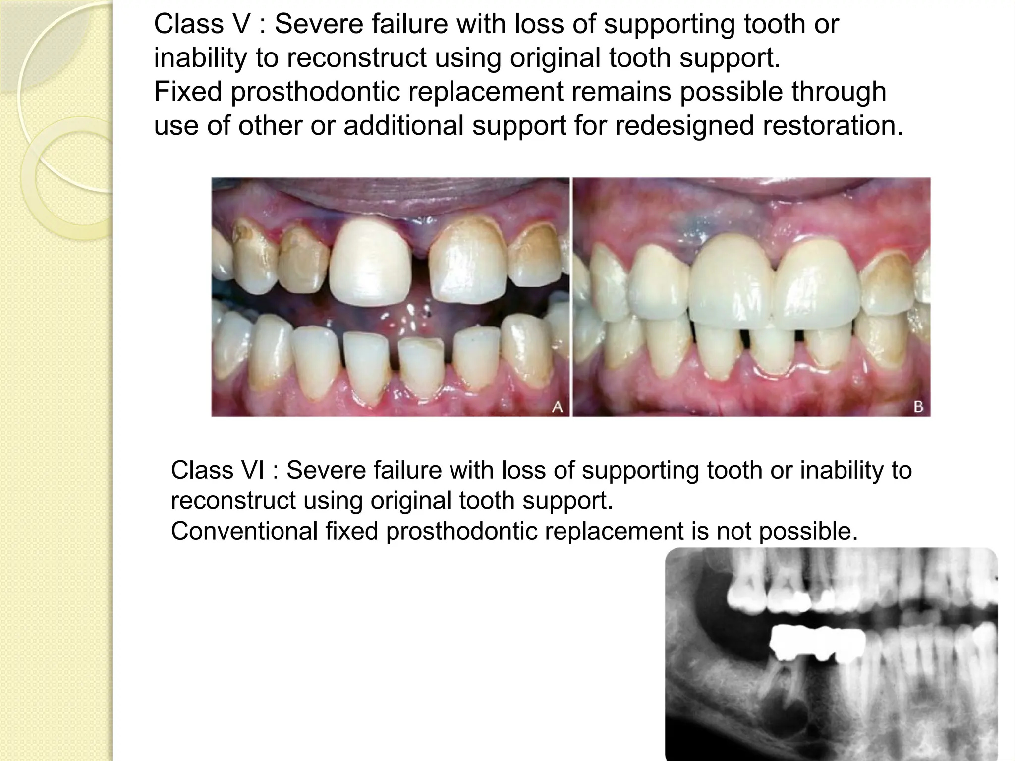 Failures in FPD and their management.pptx