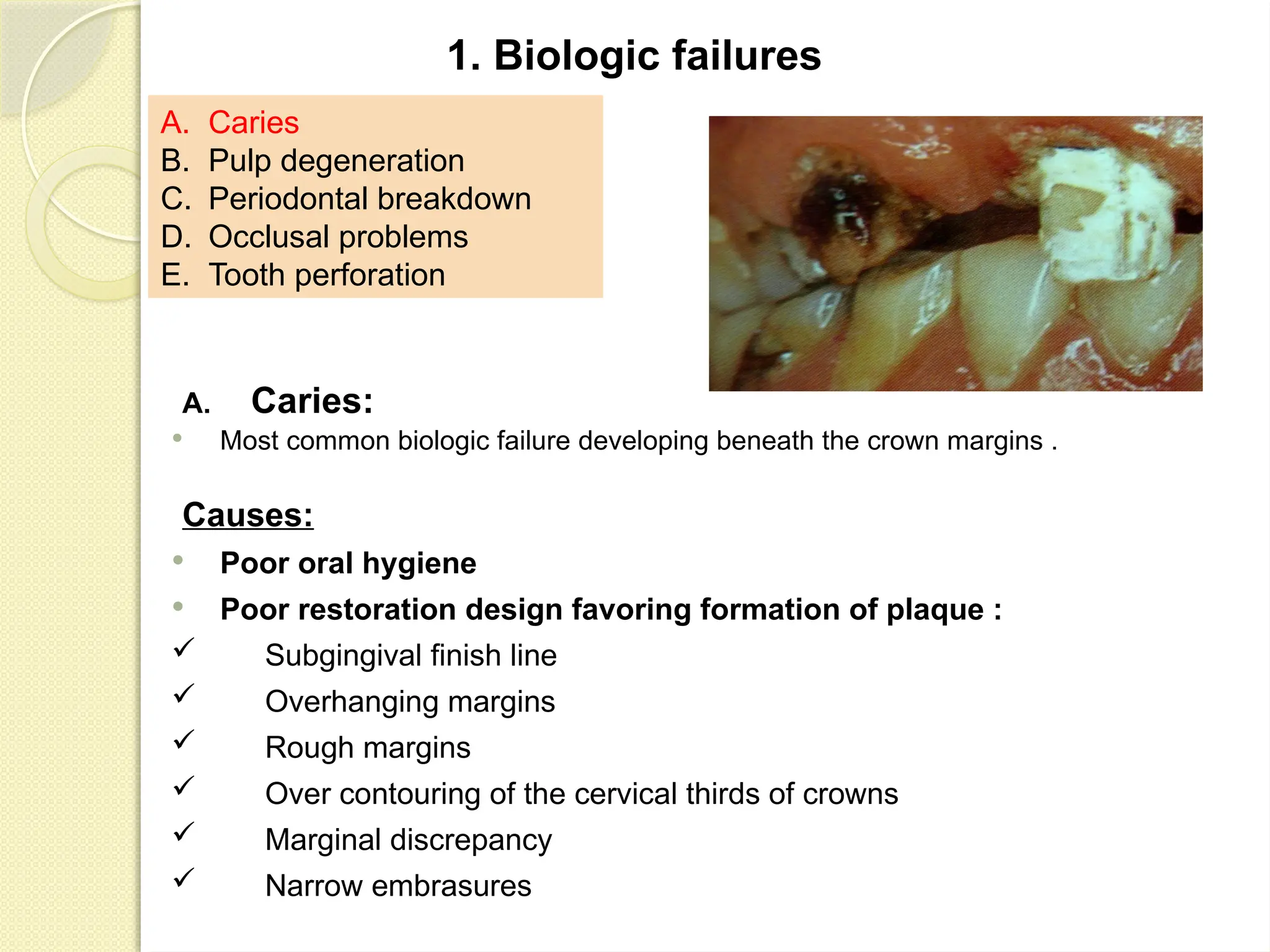 Failures in FPD and their management.pptx