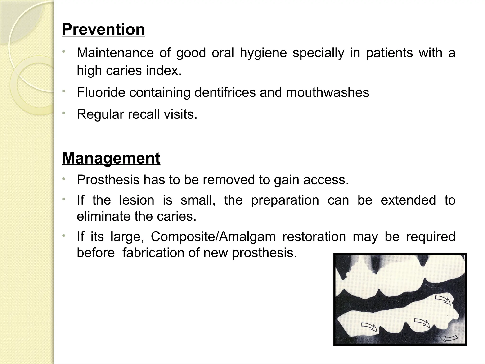 Failures in FPD and their management.pptx
