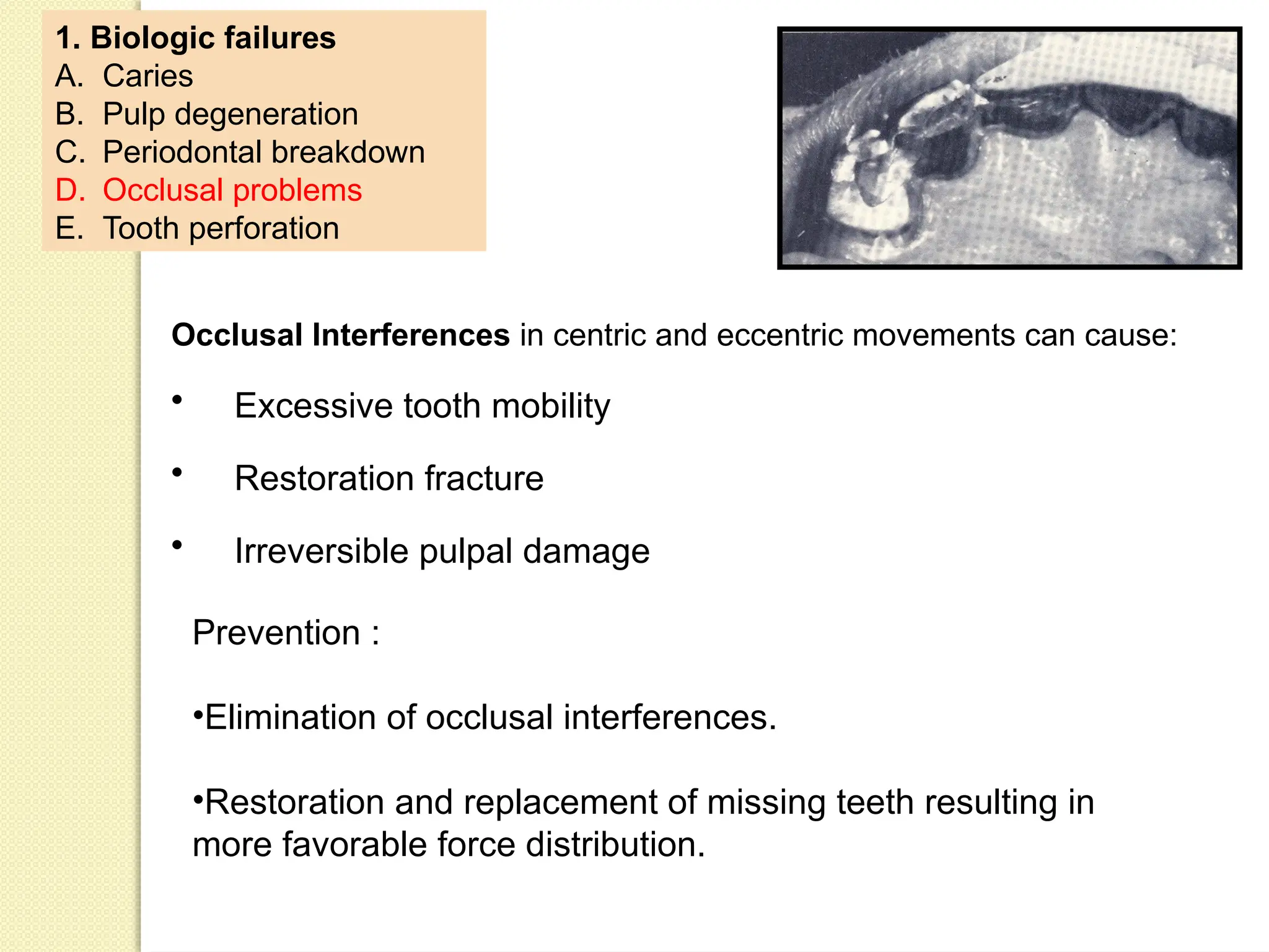 Failures in FPD and their management.pptx