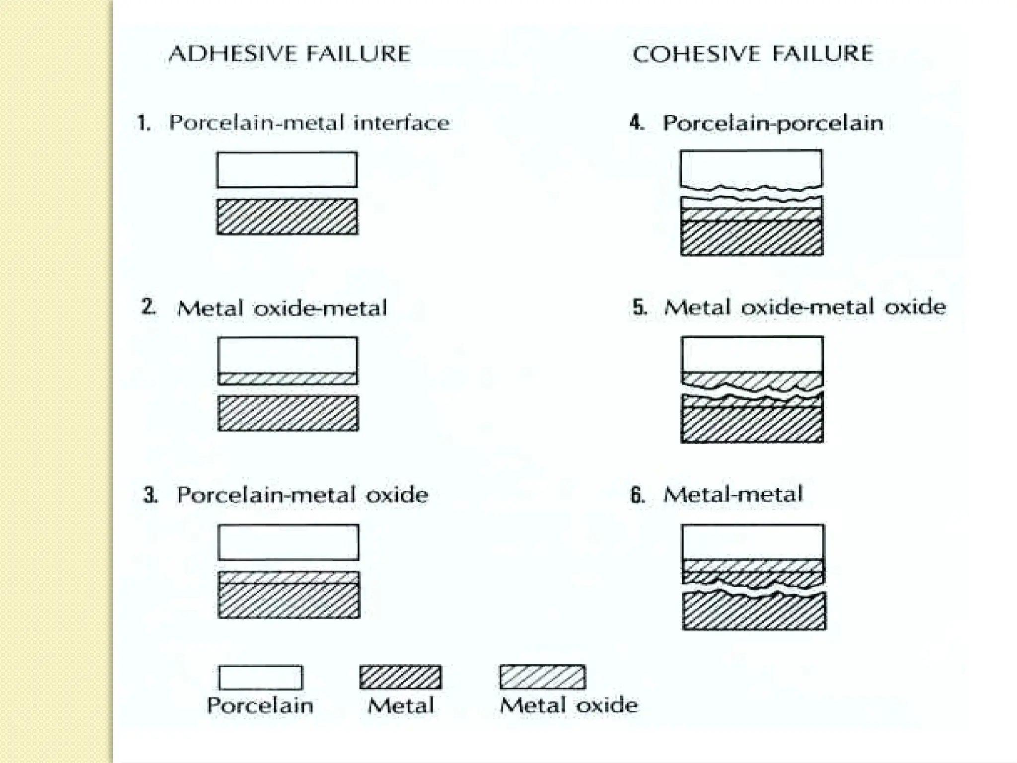 Failures in FPD and their management.pptx