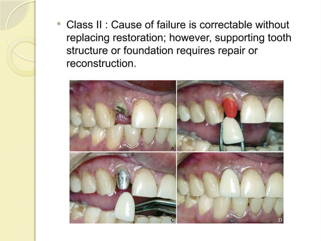 Failures in FPD and their management.pptx