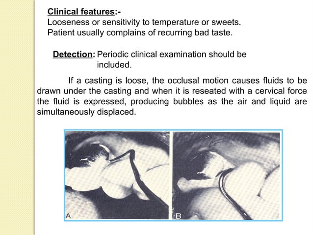 Failures in FPD and their management.pptx