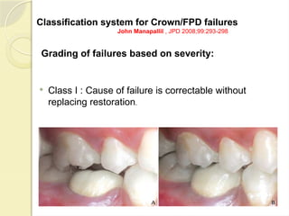 Failures in FPD and their management.pptx