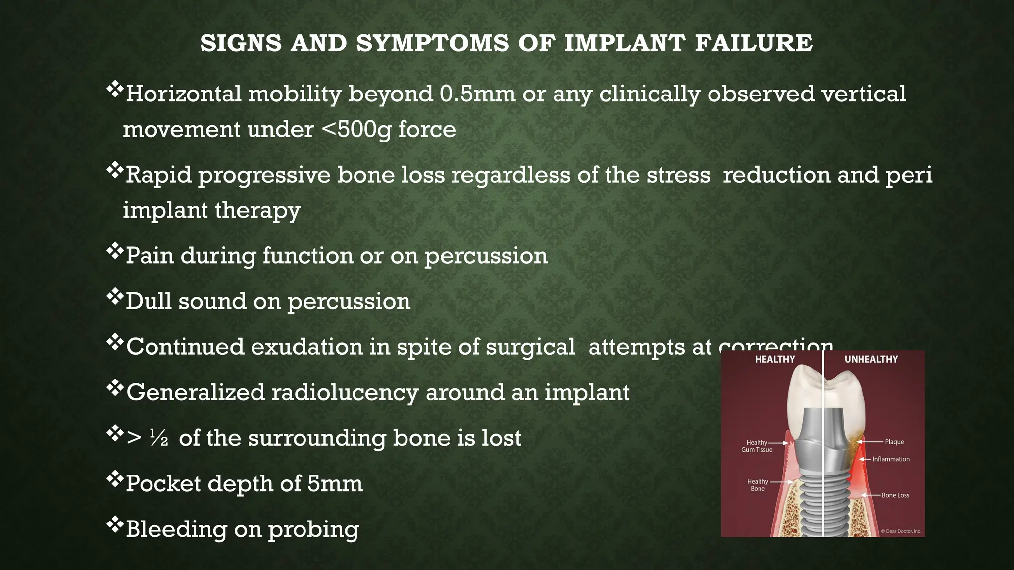 Failures in implants.pptx,,,,,,,,,,,,,,,,,,,,,,,, | PPTX